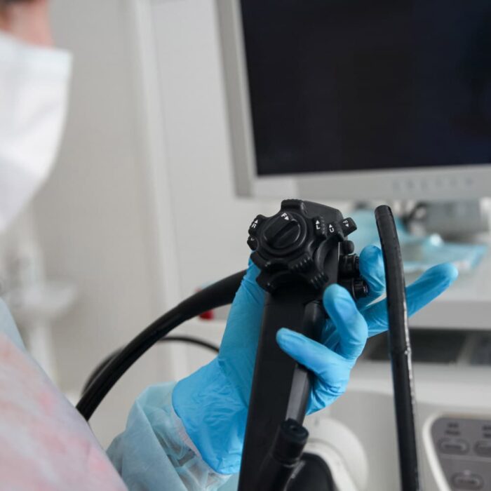 Gastroscopy (Upper Endoscopy) Singapore - Procedure & Cost